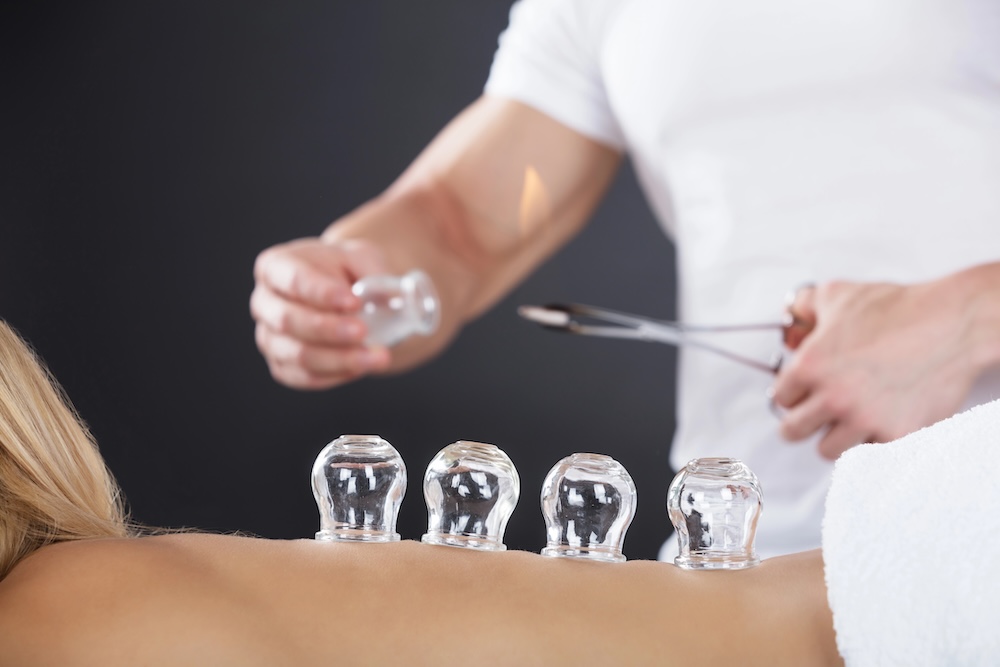 The Healing Power of Cupping and Massage in Integrative Medicine